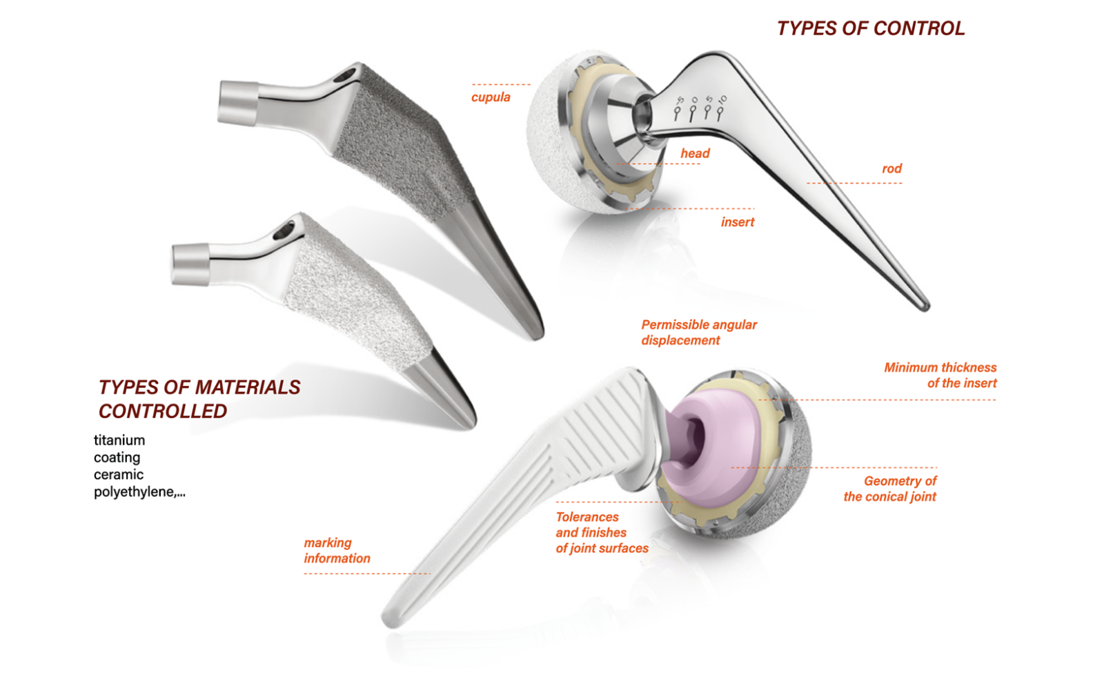 Orthopaedic implants - SETSMART