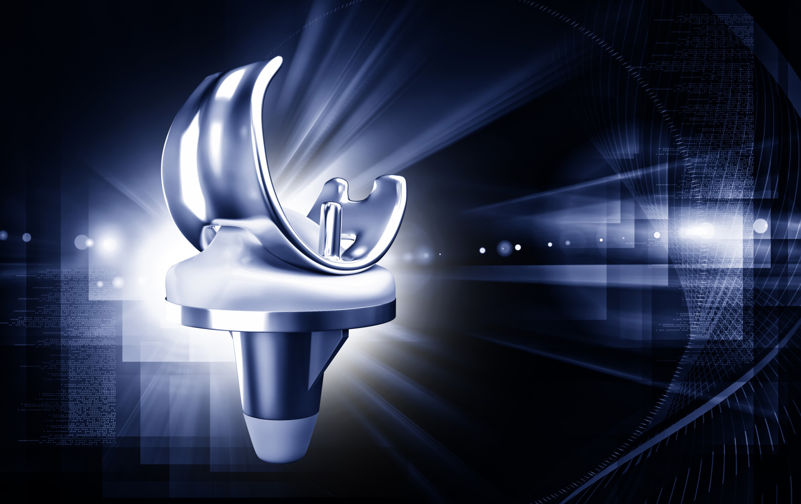 MEDICAL : Dimensional controls of orthopaedic implants - SETSMART